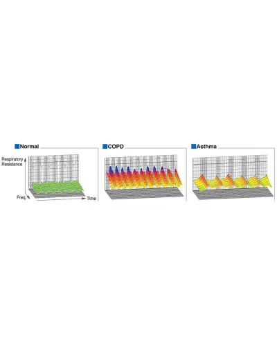 Appareil de ponction pulmonaire-MostGraph-02