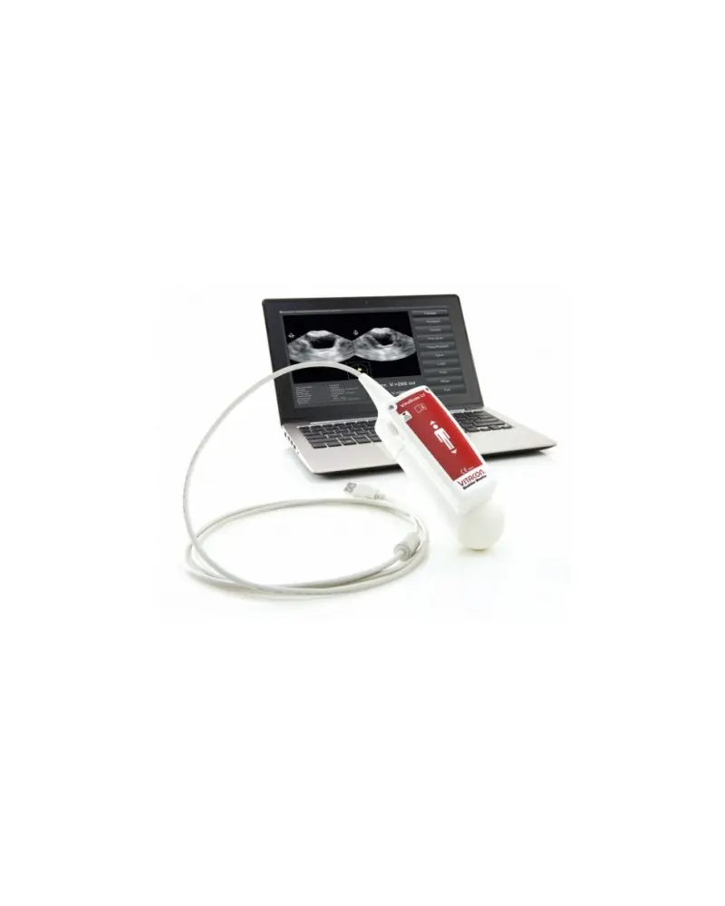 BLADDER SCANNER VITASCAN AVEC LOGICIEL