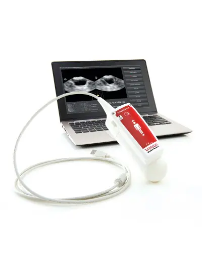 BLADDER SCANNER VITASCAN AVEC LOGICIEL